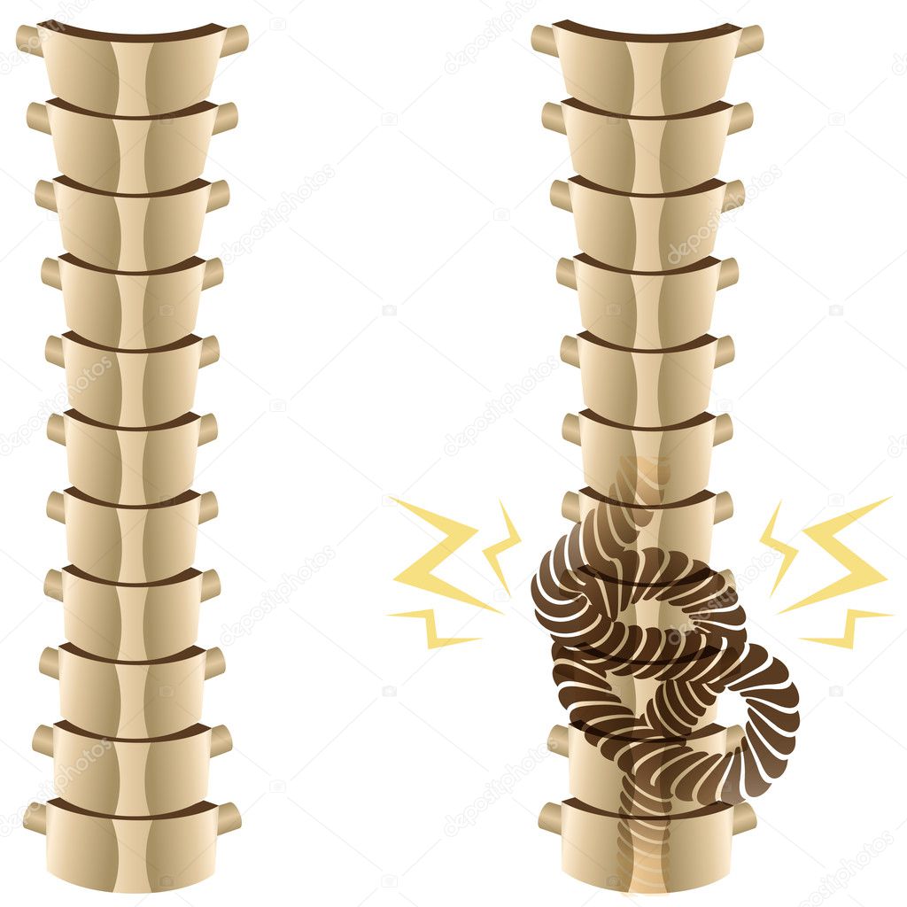Columna anudada Vector de stock #11576081 de ©cteconsulting
