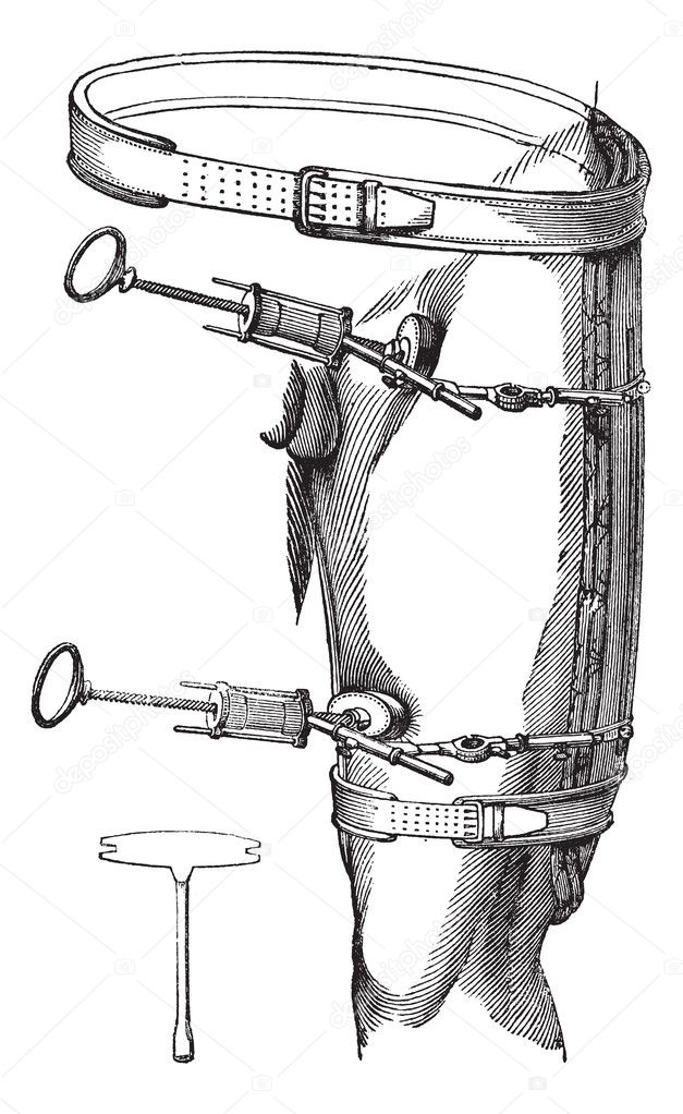 Fig 89 Compresión De La Pierna De La Aorta Utilizando Una Compresión