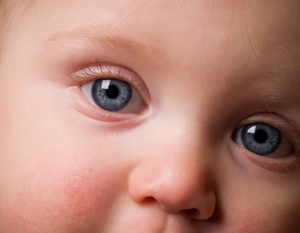 Strabismus in children Stock Photos, Royalty Free Strabismus in ...