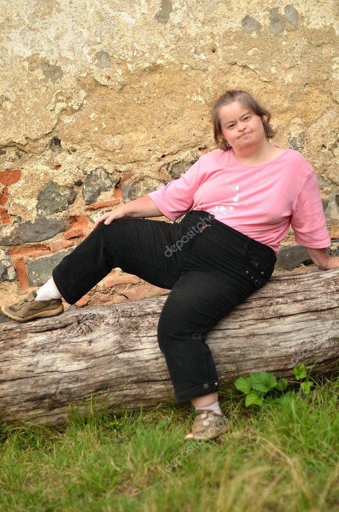 Woman with down syndrome Stock Photo by ©muro 11878690