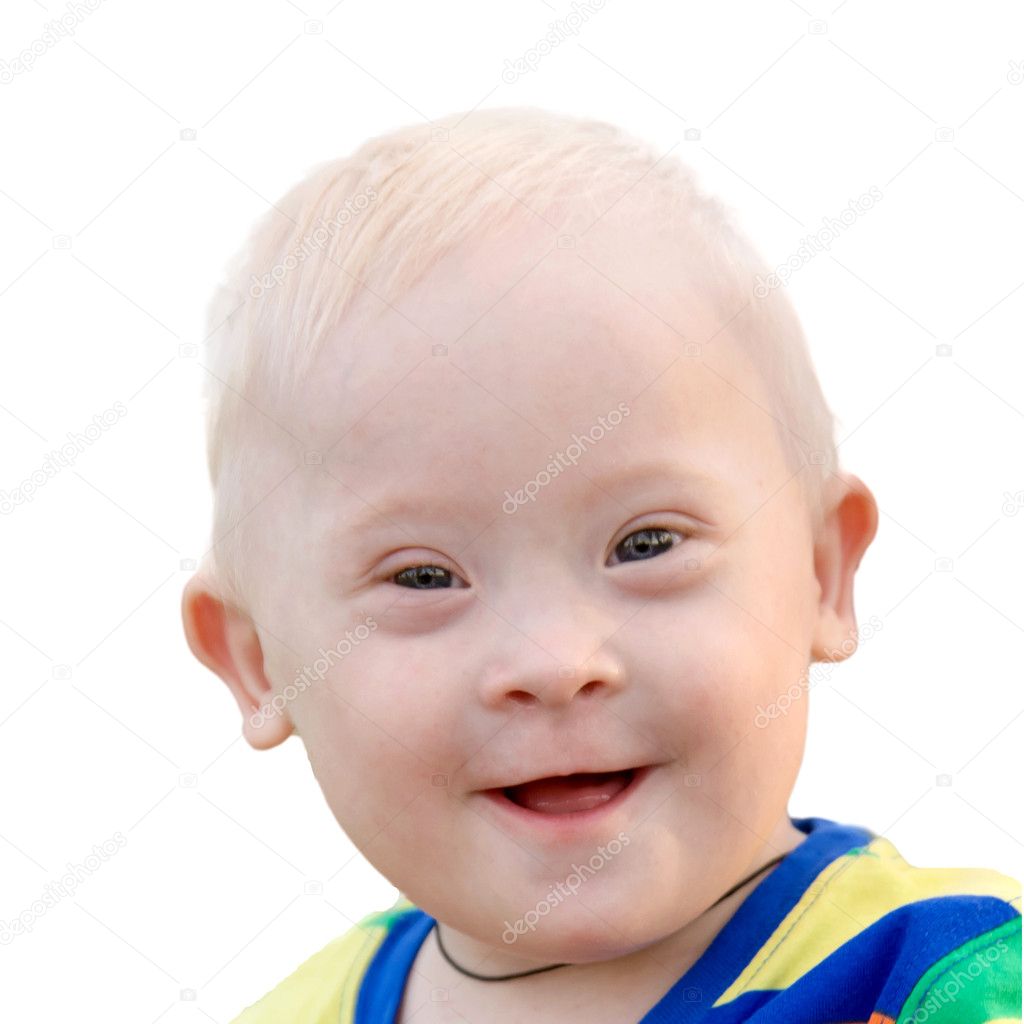 Little baby boy with Down syndrome smiling — Stock Photo © Vitalinka ...
